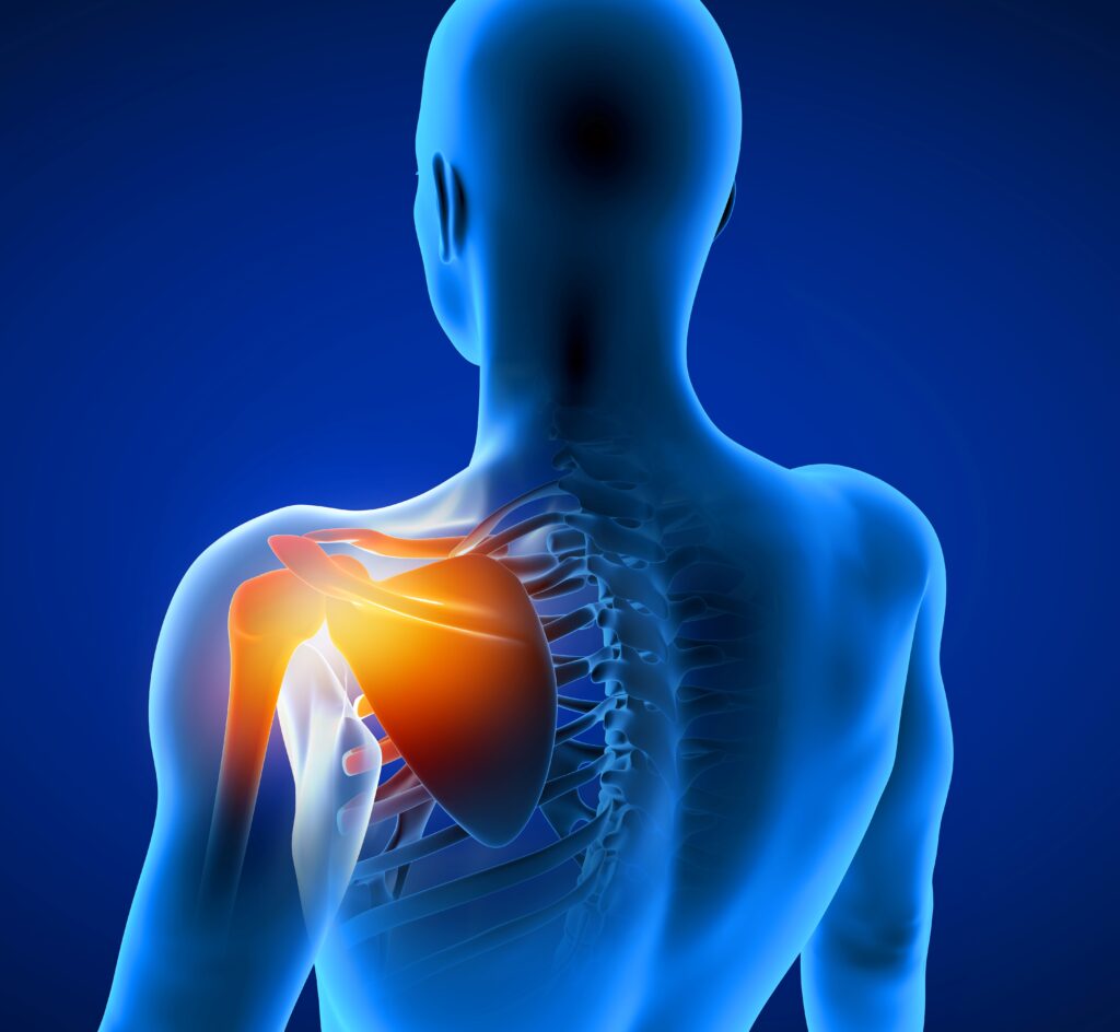 Shoulder Arthritis - Assoc. Prof. Dr. Cavit Meclisi